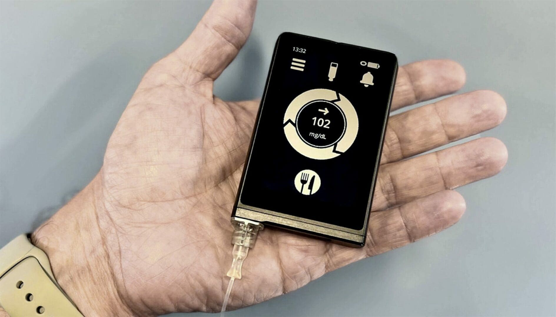 Bionic Pancreas: Self-Dosing Insulin Breakthrough - Christian Kromme